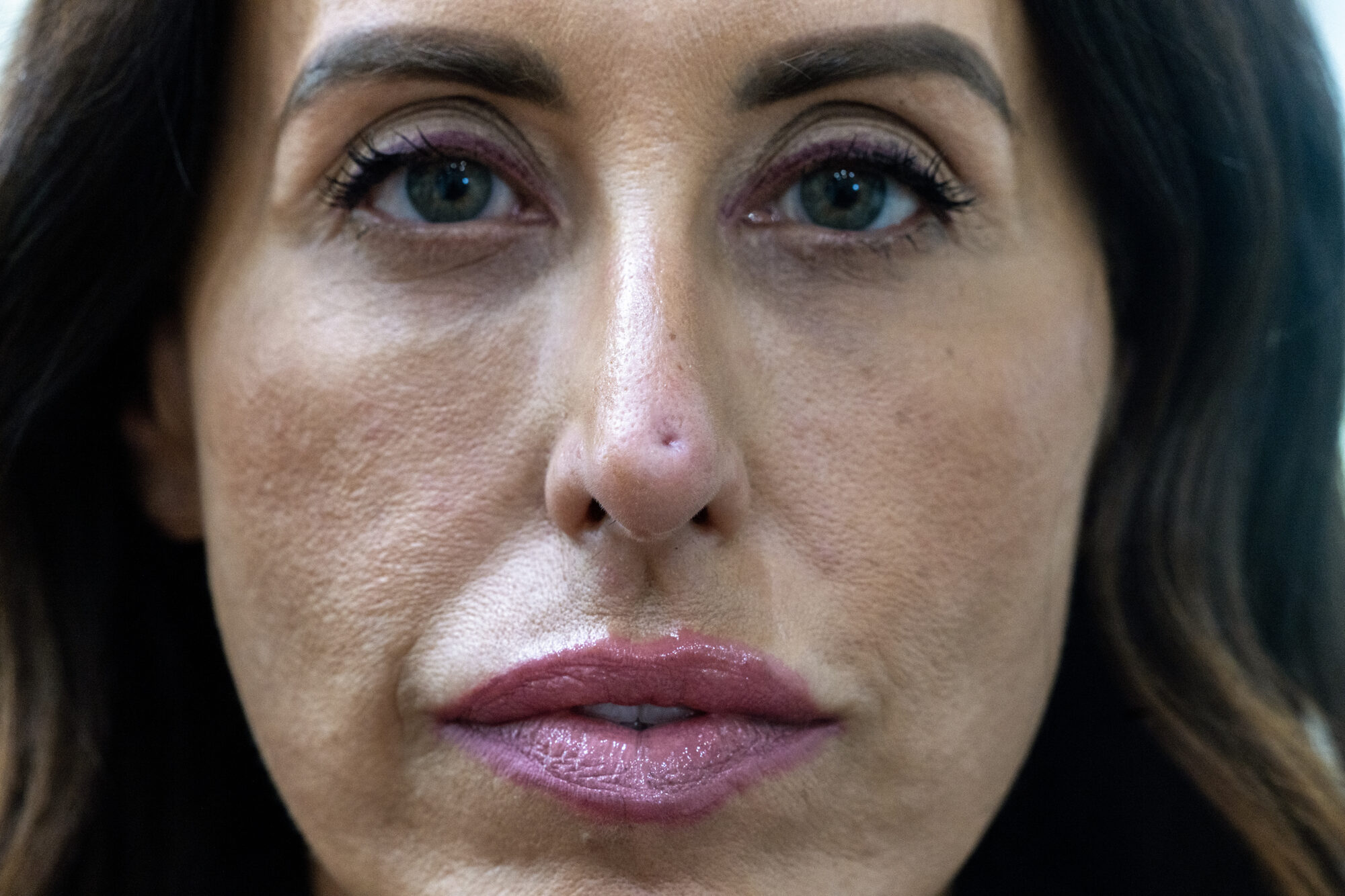 Quick surgeries, scars and facelifts that fade: Complaints pile up ...