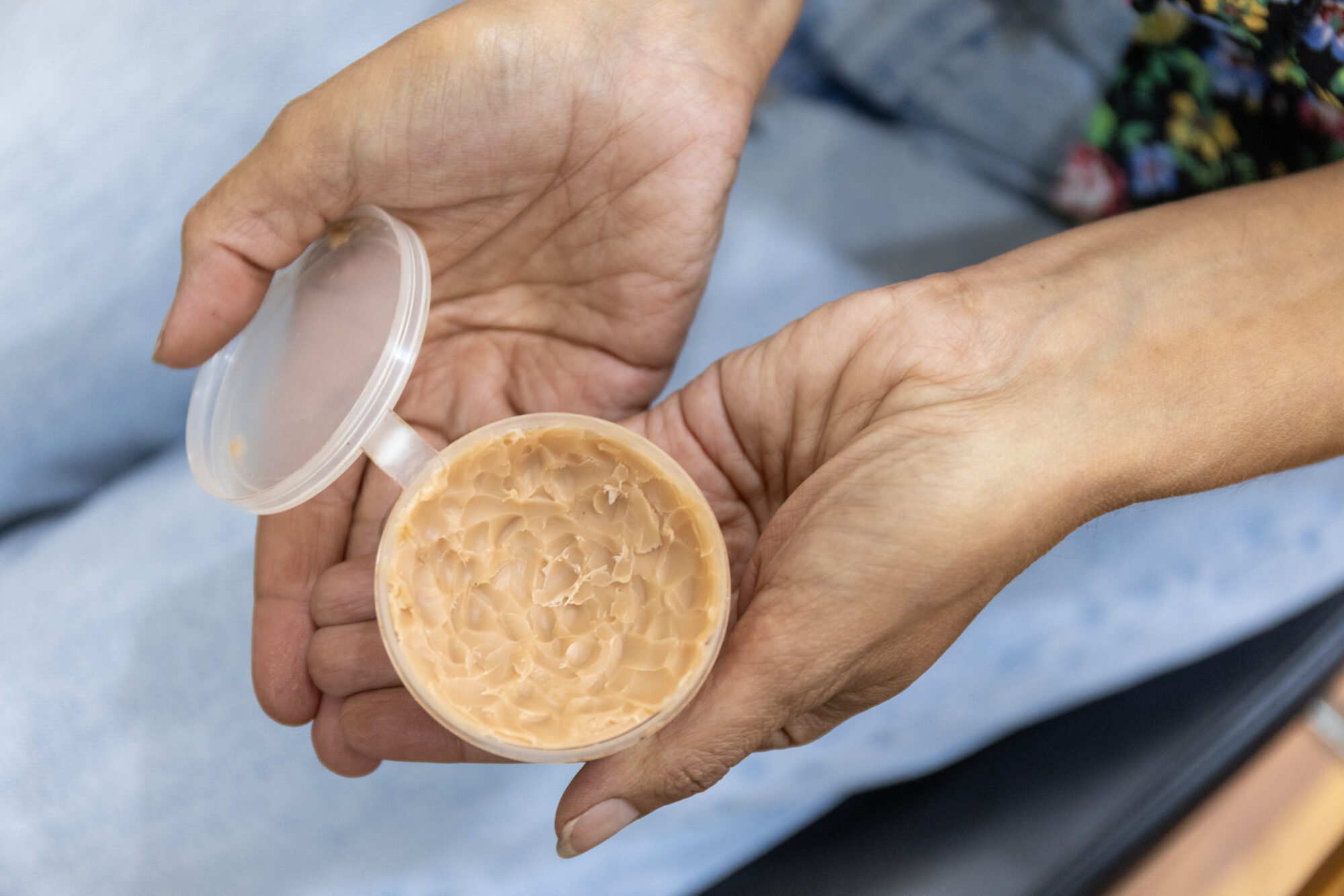 Quick surgeries, scars and facelifts that fade: Complaints pile up ...