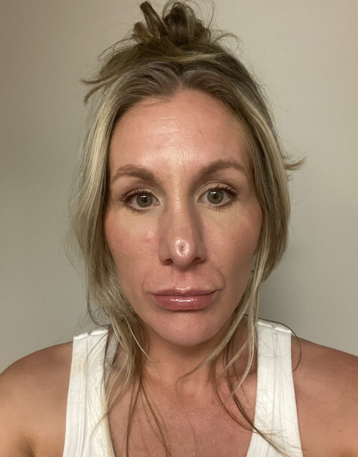 Quick surgeries, scars and facelifts that fade: Complaints pile up ...