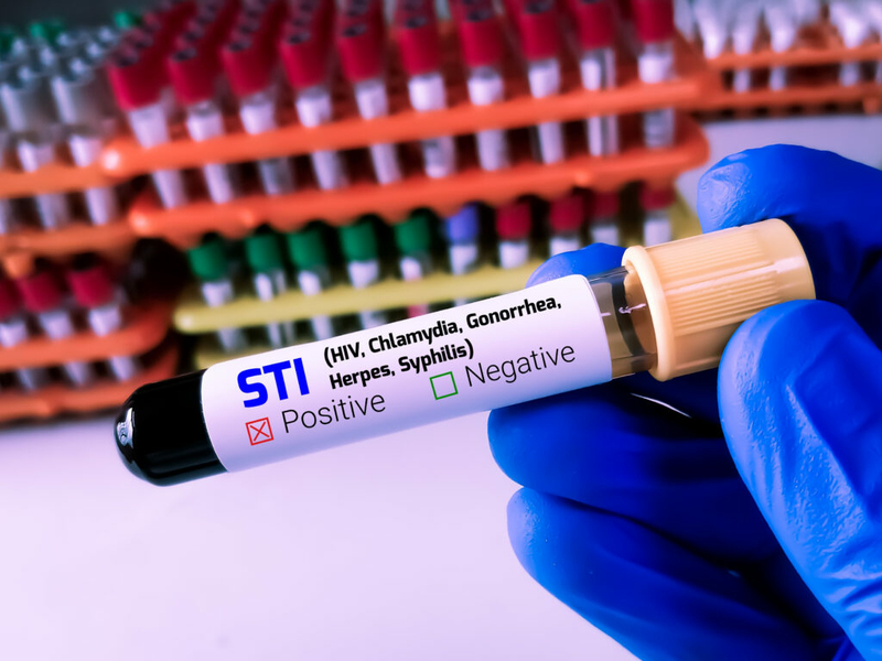 Oklahoma lawmakers want to criminalize spread of genital herpes ...