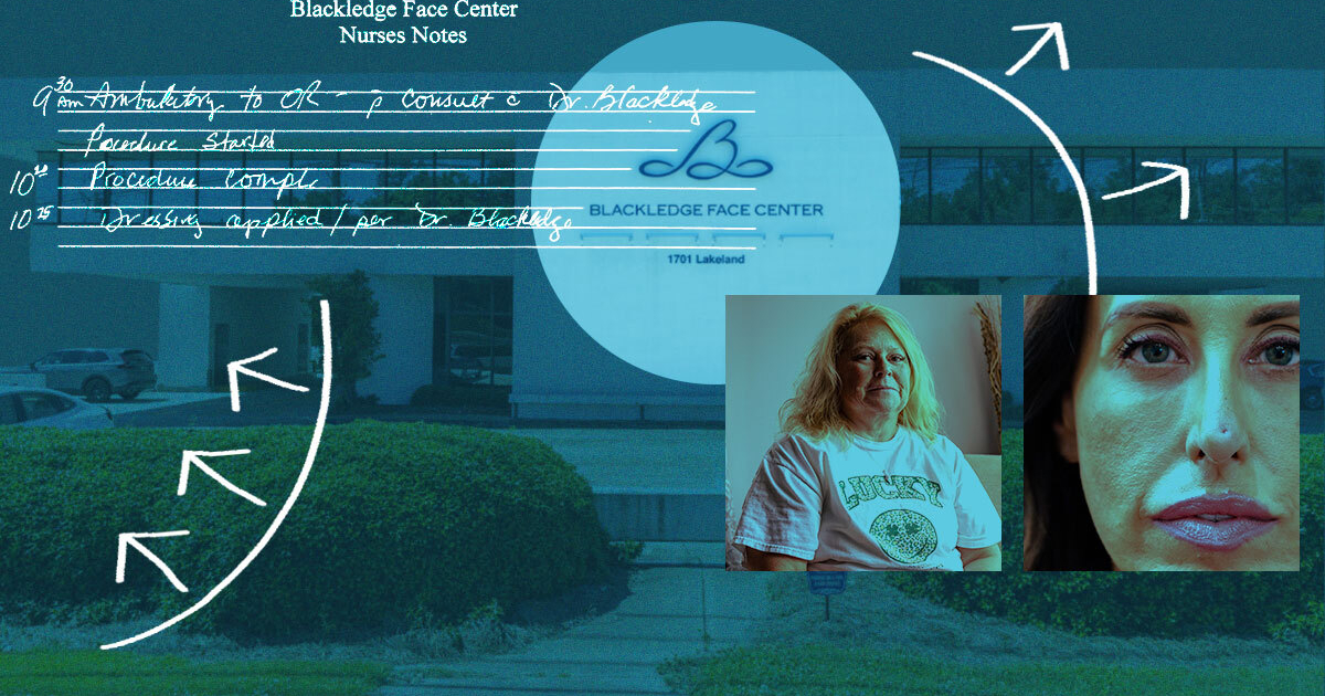 Quick surgeries, scars and facelifts that fade: Complaints pile up ...