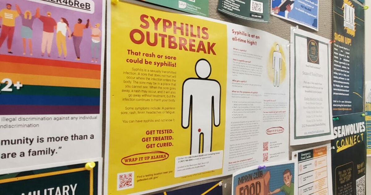 Alaska adults of childbearing age advised to get testing for syphilis ...